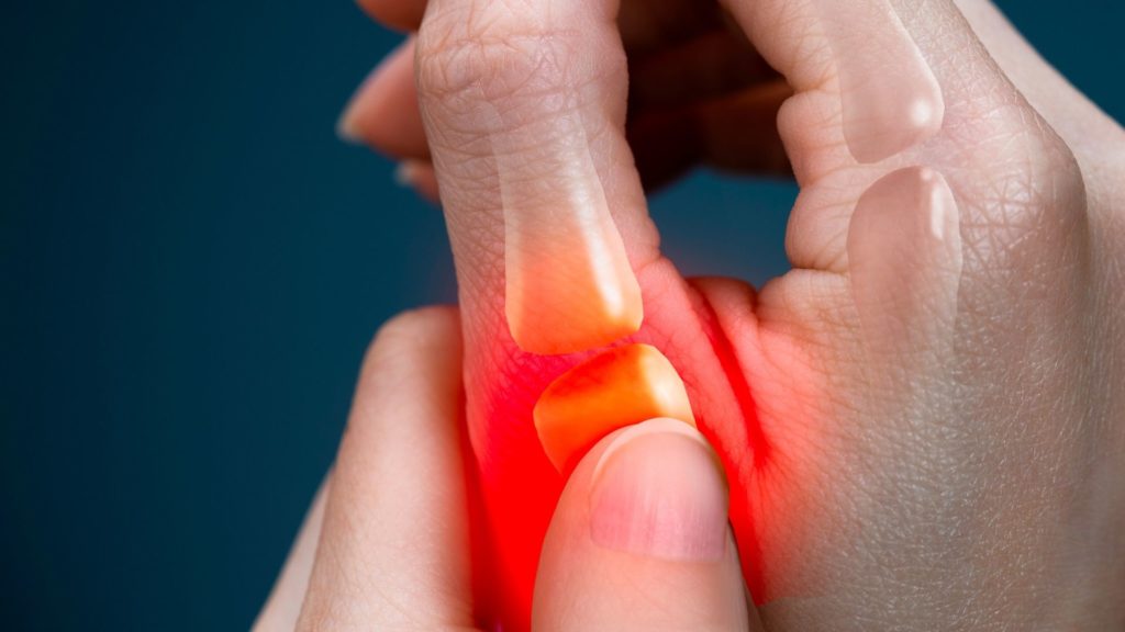 La rhizarthrose l'arthrose du pouce - A propos de l'orthopédie